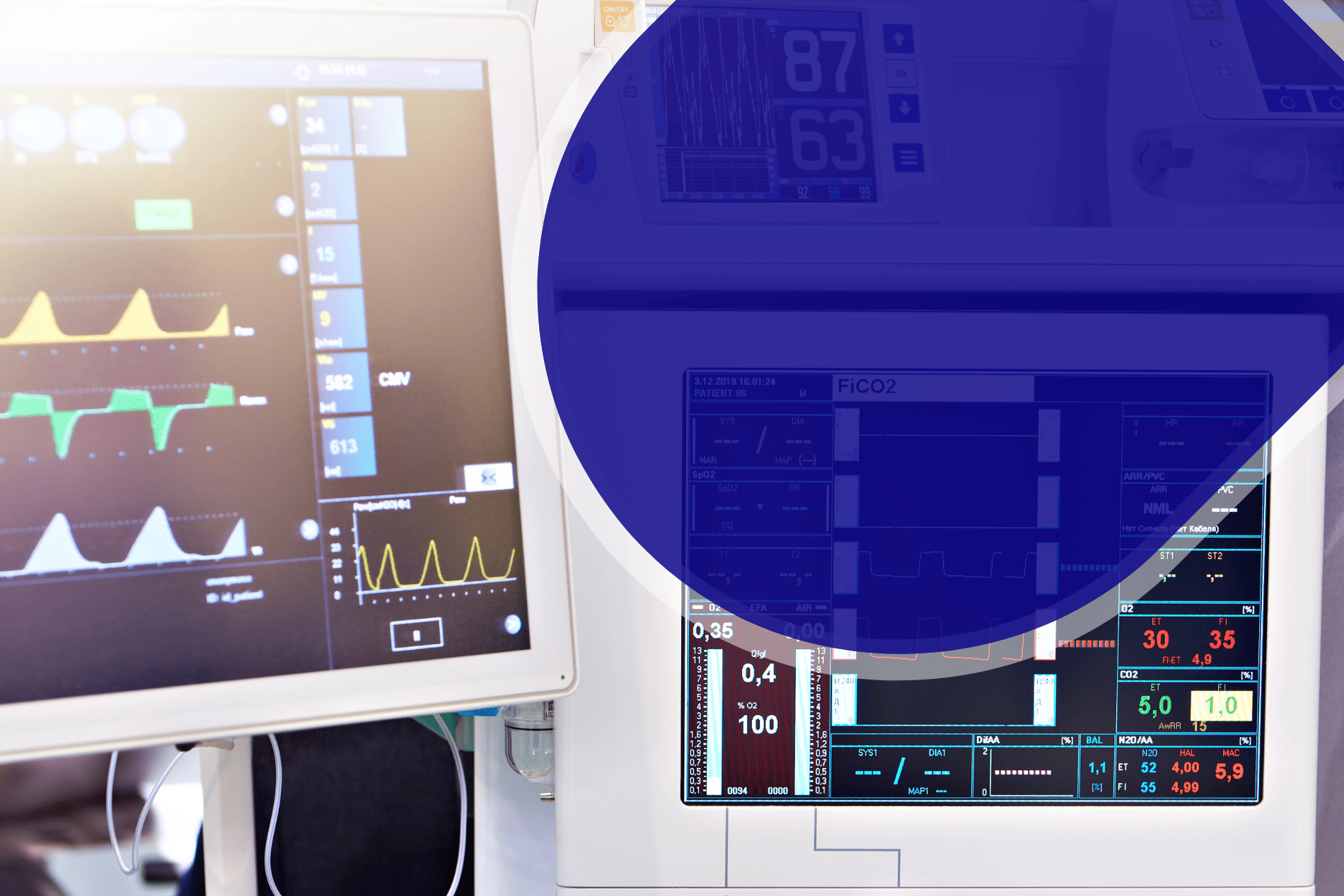 Medical Device Classification Rules: The First Step Toward a Successful ...